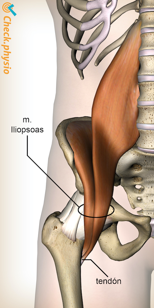 Síndrome del iliopsoas | Causa, síntomas y tratamiento